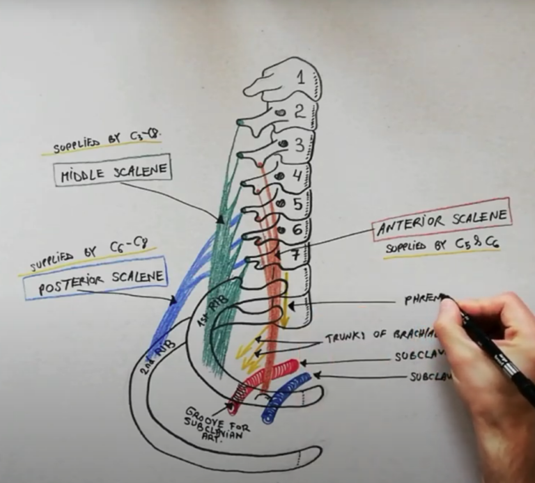 TOS, anterior supraclavicular approach: tips & tricks - Andreas M ...